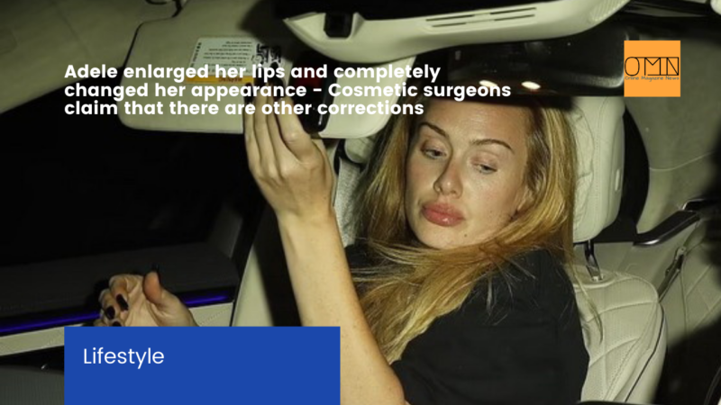 Adele enlarged her lips and completely changed her appearance ...